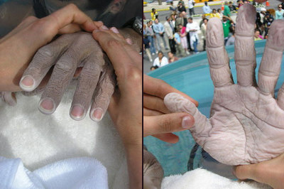 David Blaine's shriveled hands - OMG.BLOG