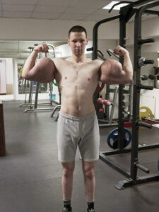 OMG, step inside the bizarre world of Synthol-overloaded bodybuilders - OMG.BLOG